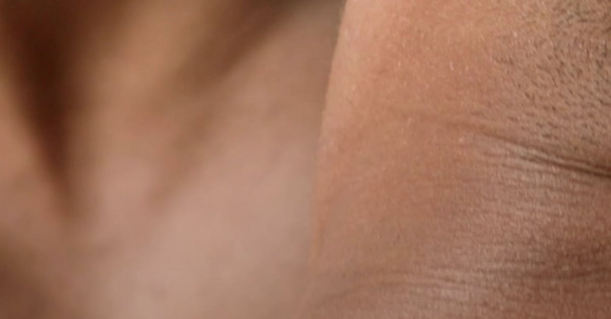 Saw Palmetto Benefits for Men | hims